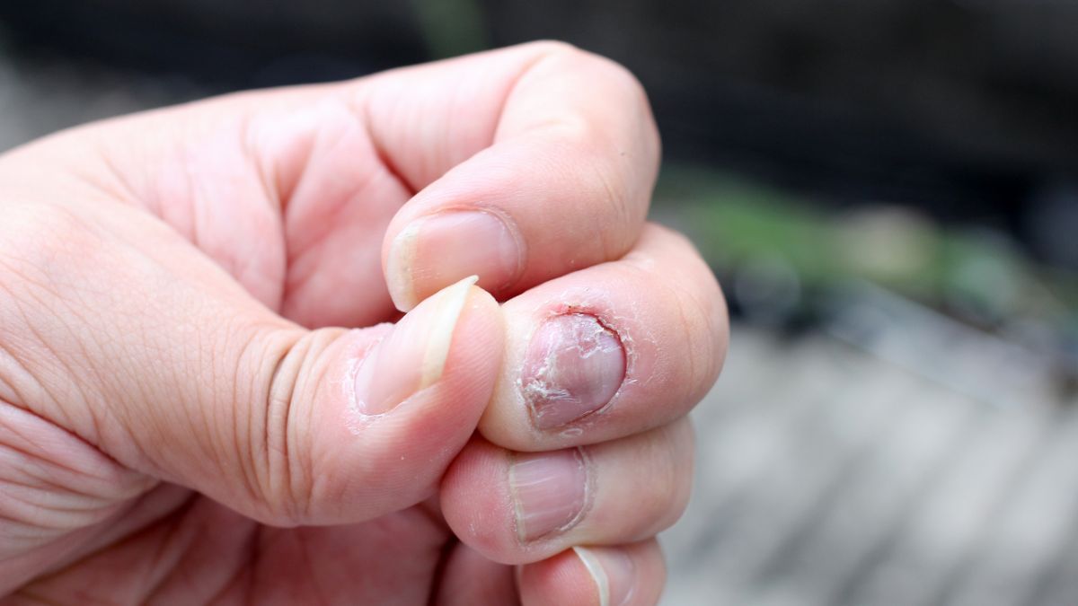 Mengenal Manfaat Rontgen Thorax dan Prosedurnya - KlikDokter