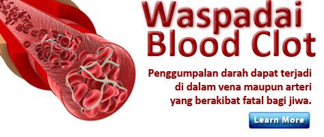 Waspadai Gumpalan Darah - KlikDokter