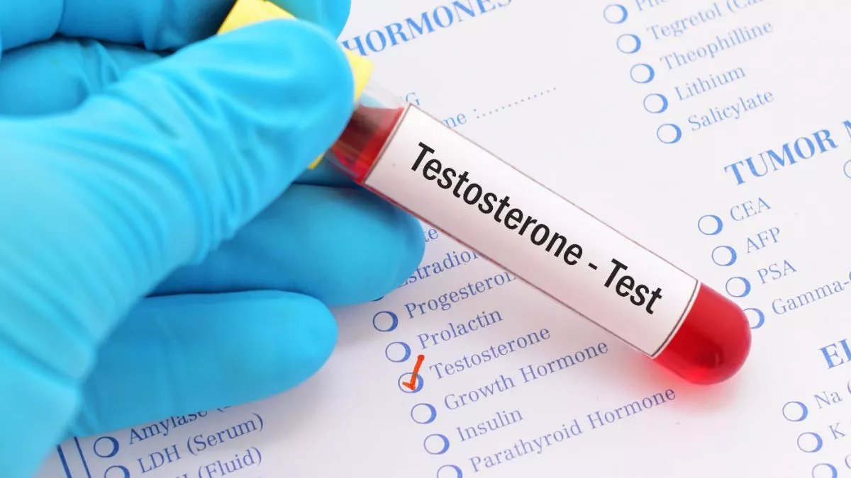 Tes Kadar Hormon Testosteron, Begini Prosedur dan Hasil Normalnya ...