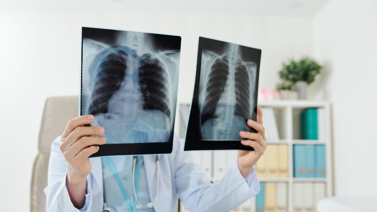 Mengenal Manfaat Rontgen Thorax dan Prosedurnya - KlikDokter