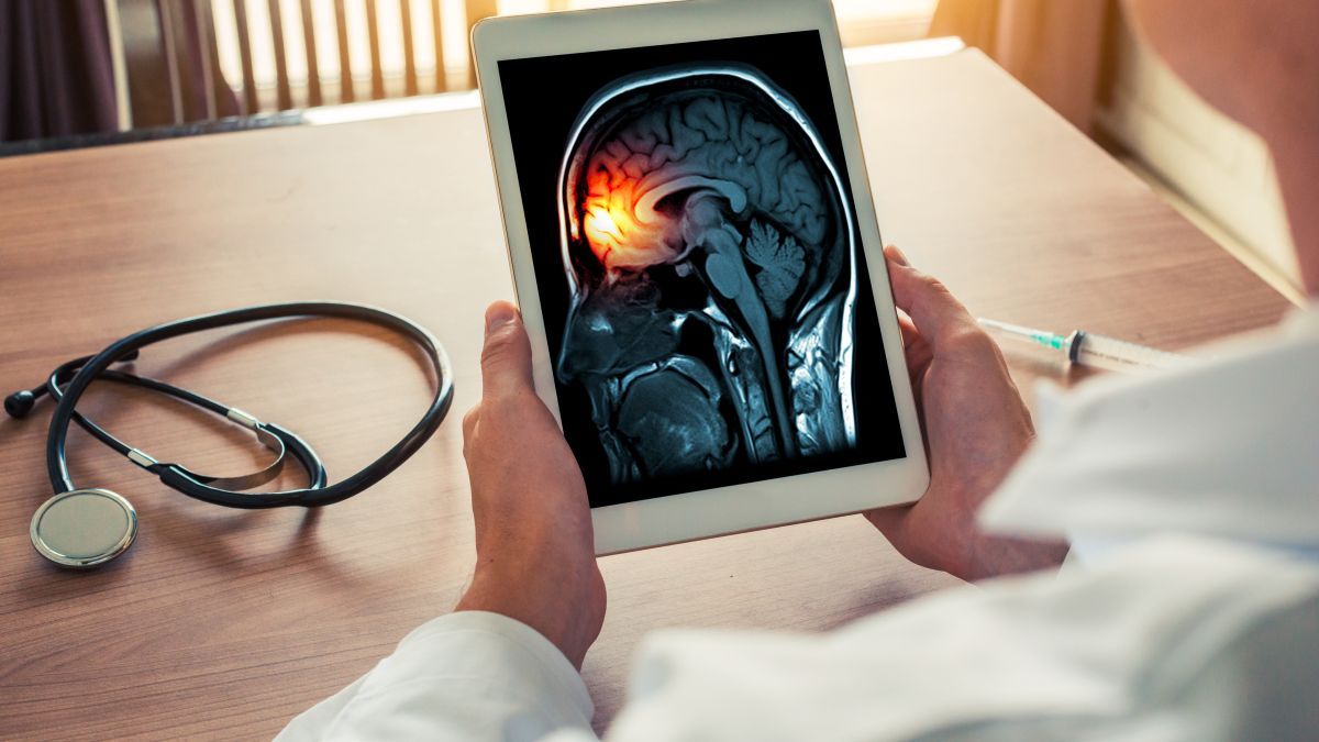 Hidrosefalus - Penyebab, Gejala, dan Pengobatan - KlikDokter