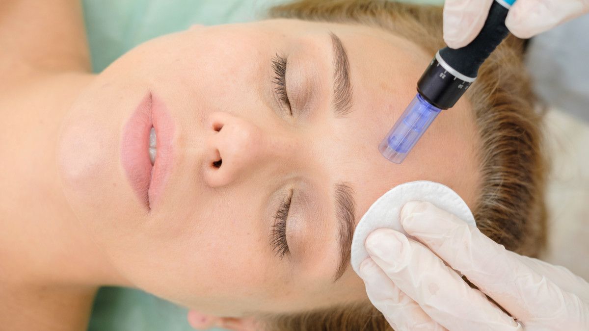 Mengenal Microneedling, Perawatan Wajah dengan Tusuk Jarum - KlikDokter