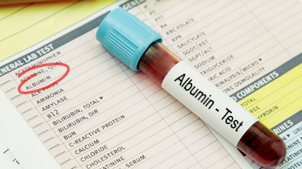 Mengenal Albumin, Kadar Normal dan Fungsinya - KlikDokter