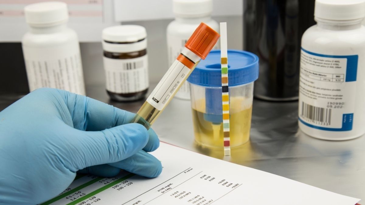 Penyebab Protein Urine Positif 1 pada Ibu Hamil dan Artinya - KlikDokter