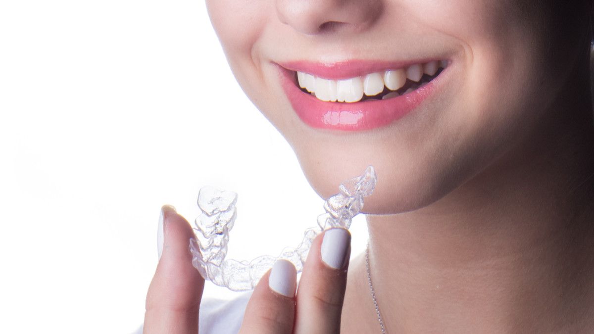 5 Manfaat Pakai Behel Transparan - KlikDokter
