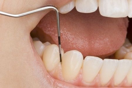 Inilah Dampak Dari Gusi Turun - KlikDokter