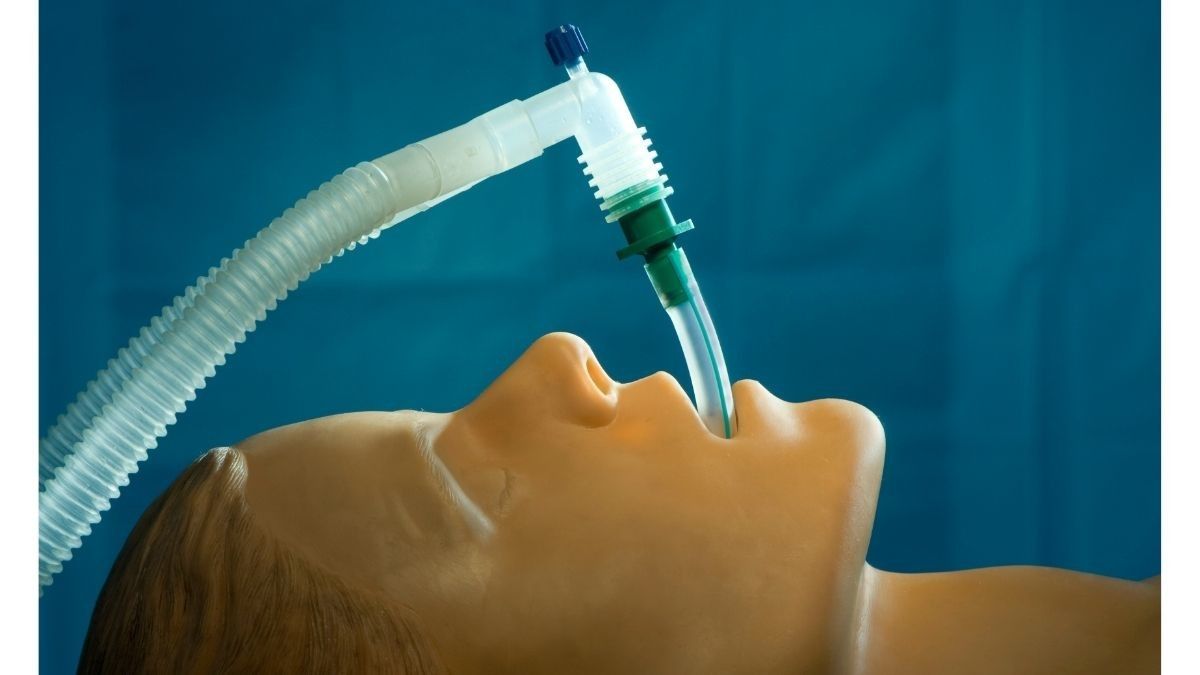 Mengenal Lebih Jauh tentang Intubasi Endotrakeal - KlikDokter