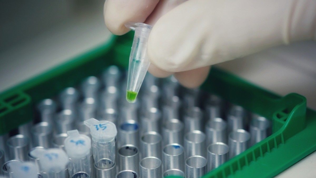 Mulai Gunakan Rapid Test Virus Corona, Apa Bedanya dengan PCR? - KlikDokter