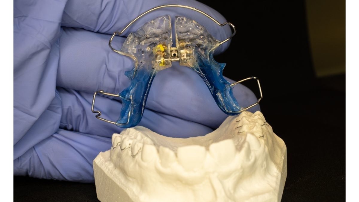 Penting! Ini Cara Membersihkan Retainer Gigi yang Benar - KlikDokter