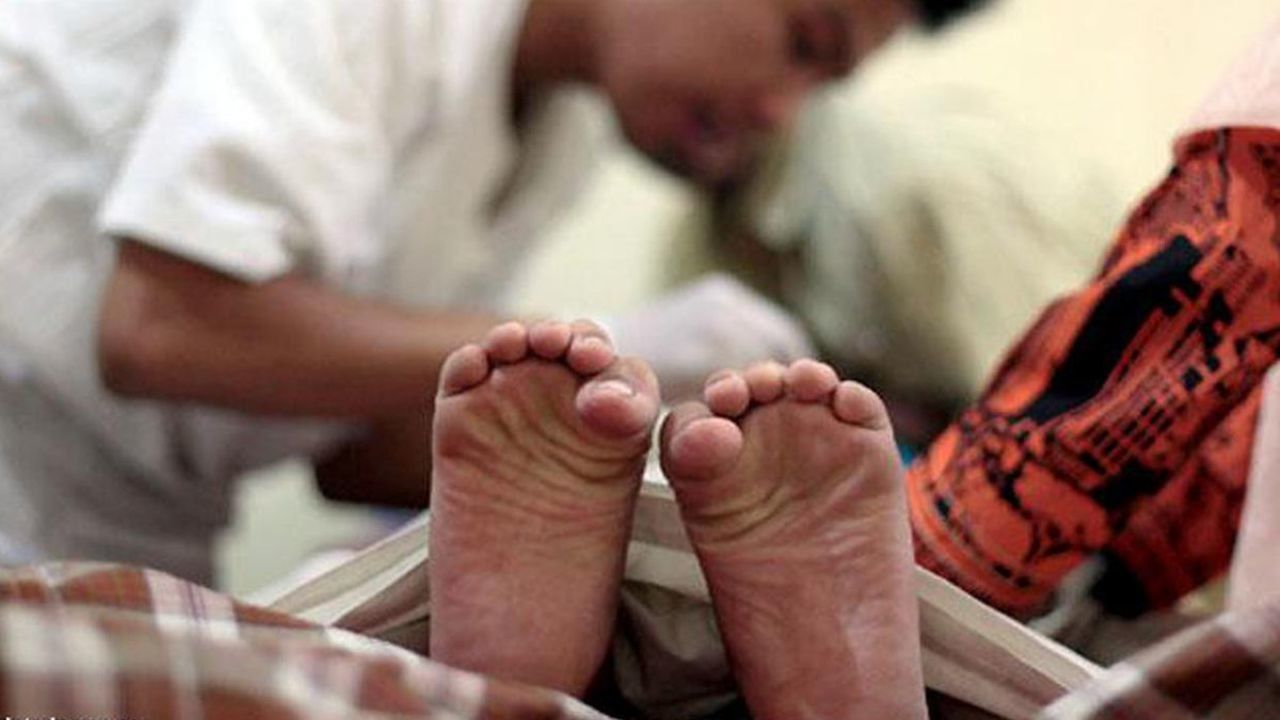 Sunat dengan Metode Stapler, Apa Kelebihannya? - KlikDokter