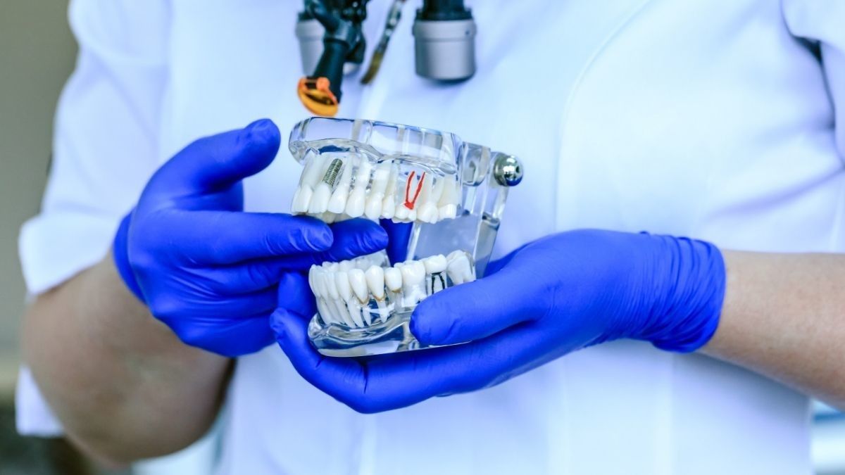 Dokter Konservasi Gigi - Perumperindo.co.id