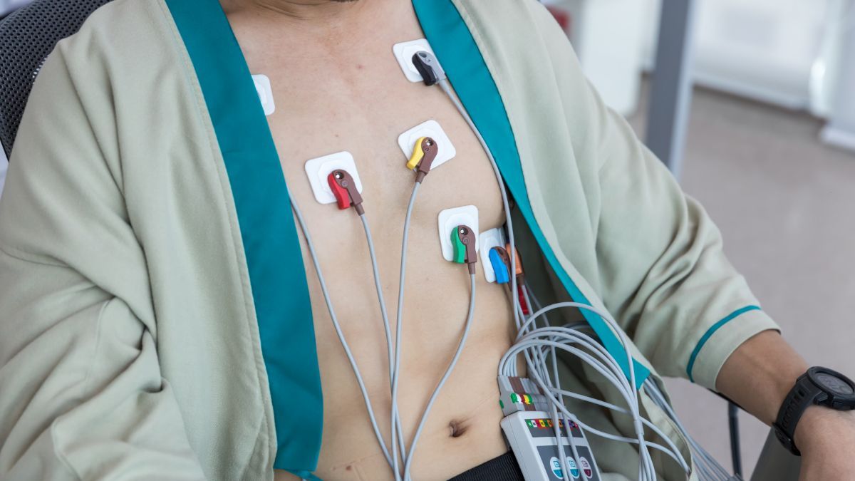 Mengenal Elektrokardiogram (EKG), dari Fungsi Hingga Prosedurnya - KlikDokter