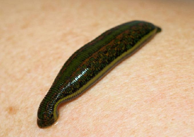 Terapi Lintah untuk Kesehatan, Efektifkah? - KlikDokter