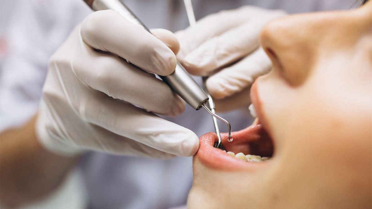Perbaiki Tampilan Gigi dengan Bonding Gigi, Ini Fungsinya - KlikDokter