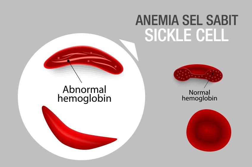 Hati-hati dengan Penyakit Keturunan yang Satu Ini - KlikDokter