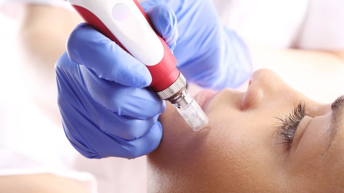 Mengenal Microneedling, Perawatan Wajah dengan Tusuk Jarum - KlikDokter