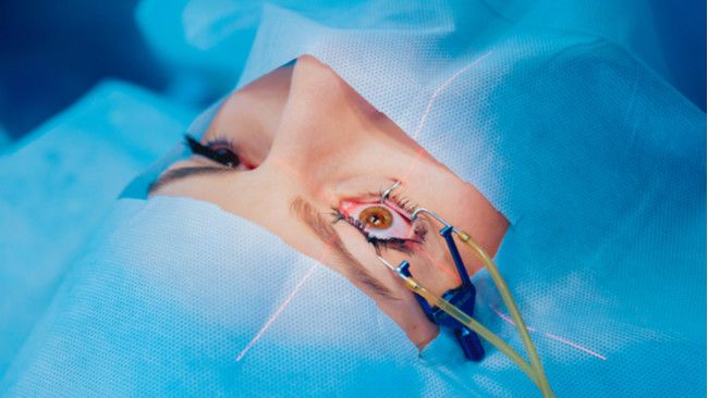 Usai LASIK, Tak Perlu Kacamata Seumur Hidup? - KlikDokter