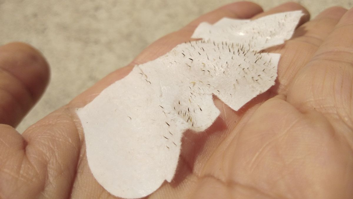 Efektifkah Menggunakan Pore Pack untuk Usir Komedo? - KlikDokter