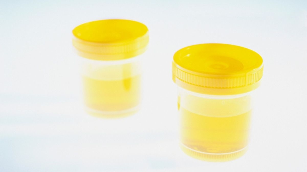 Mengenal Jenis-Jenis Inkontinensia Urine dan Gejalanya - KlikDokter