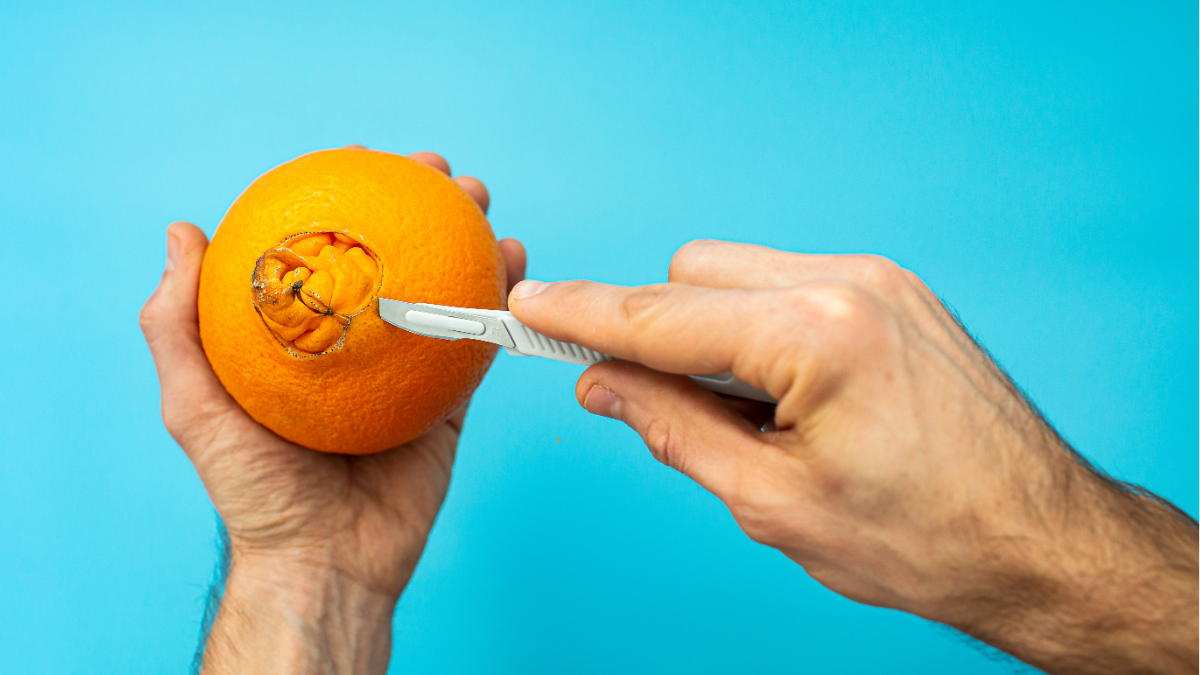 Tumor Ganas - Penyebab, Gejala, Pengobatan - KlikDokter