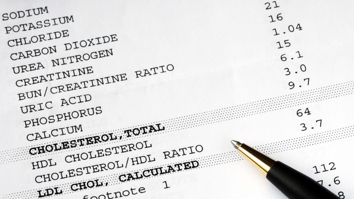 Cara Mudah Membaca Hasil Laboratorium Lengkap - KlikDokter