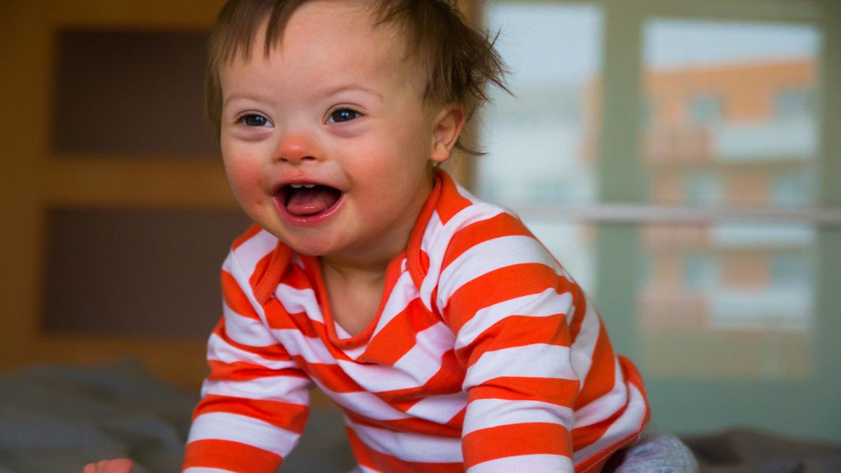 16 Ciri Bayi Down Syndrome yang Harus Dikenali Sejak Dini - KlikDokter