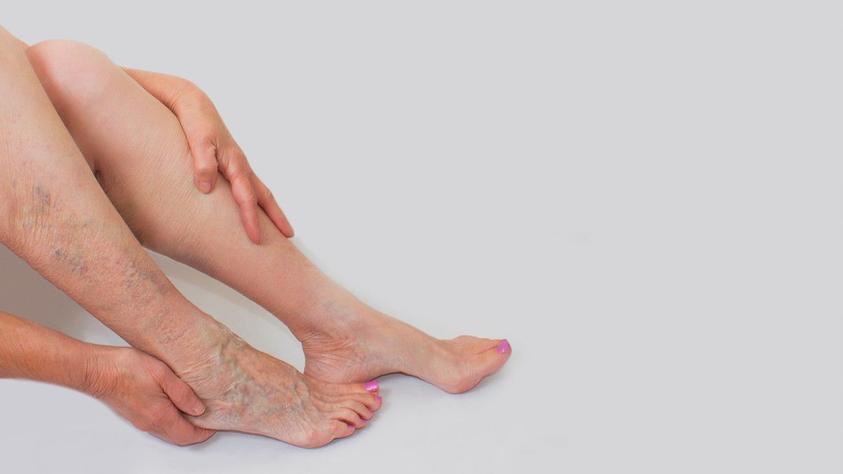 Cara Mudah Mencegah DVT Saat Naik Pesawat - KlikDokter