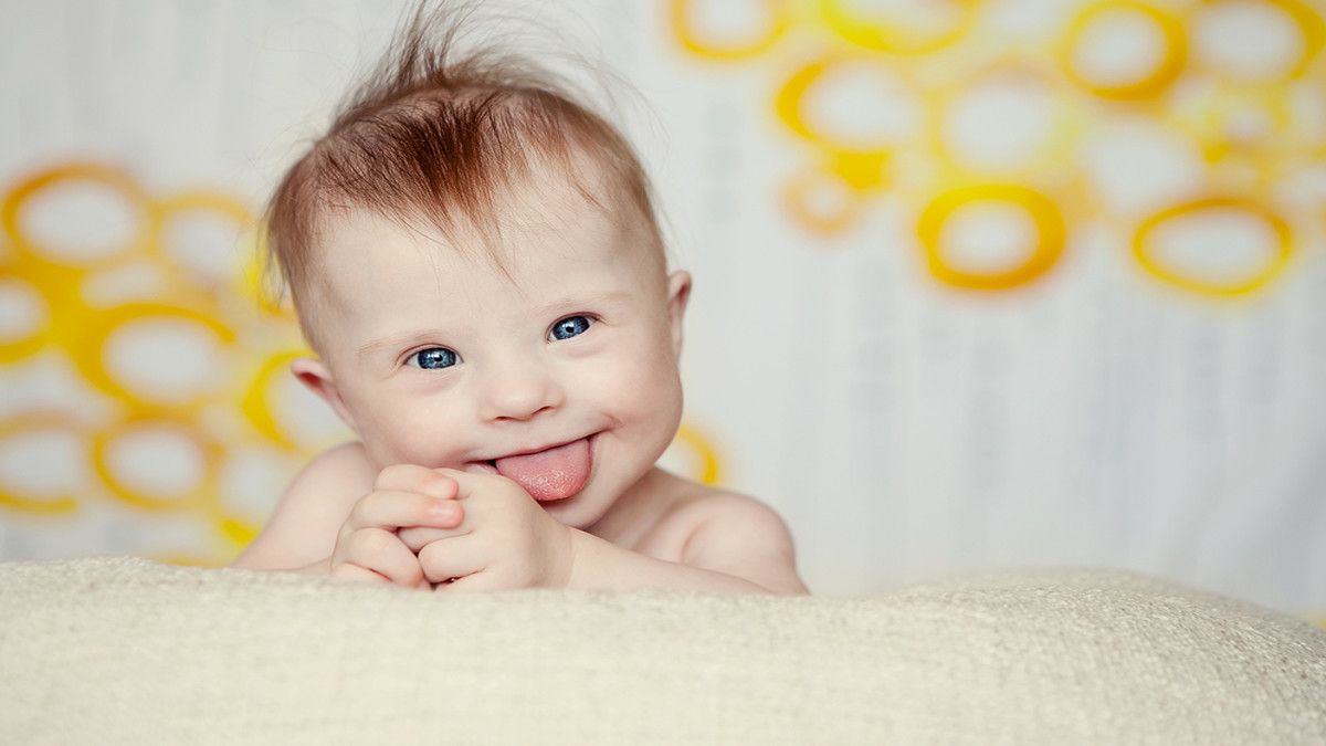 16 Ciri Bayi Down Syndrome yang Harus Dikenali Sejak Dini - KlikDokter