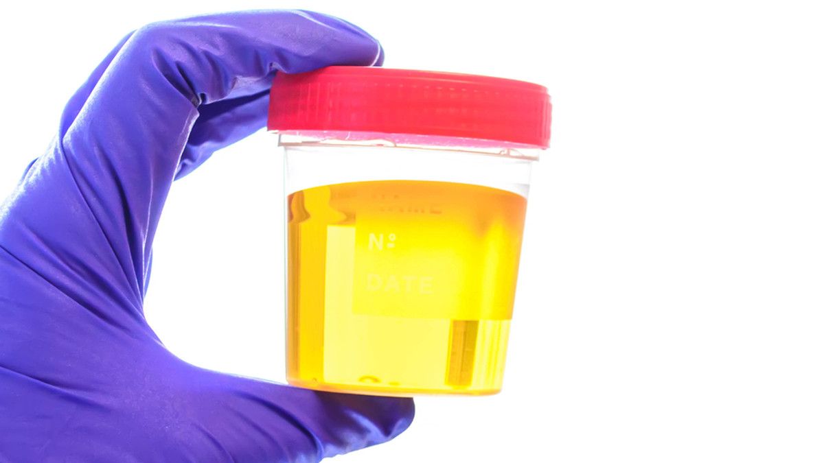 Penyebab Urine Berwarna Kuning Setelah Minum Vitamin - KlikDokter