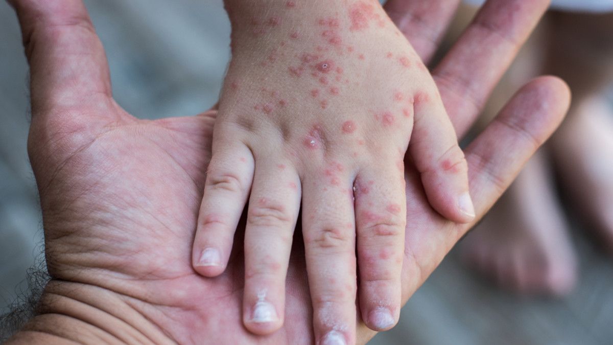 Kenali, Ini Ciri-Ciri Bayi Sakit - KlikDokter