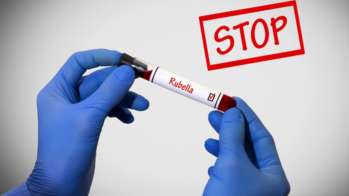 4 Obat Campak Jerman Medis - KlikDokter