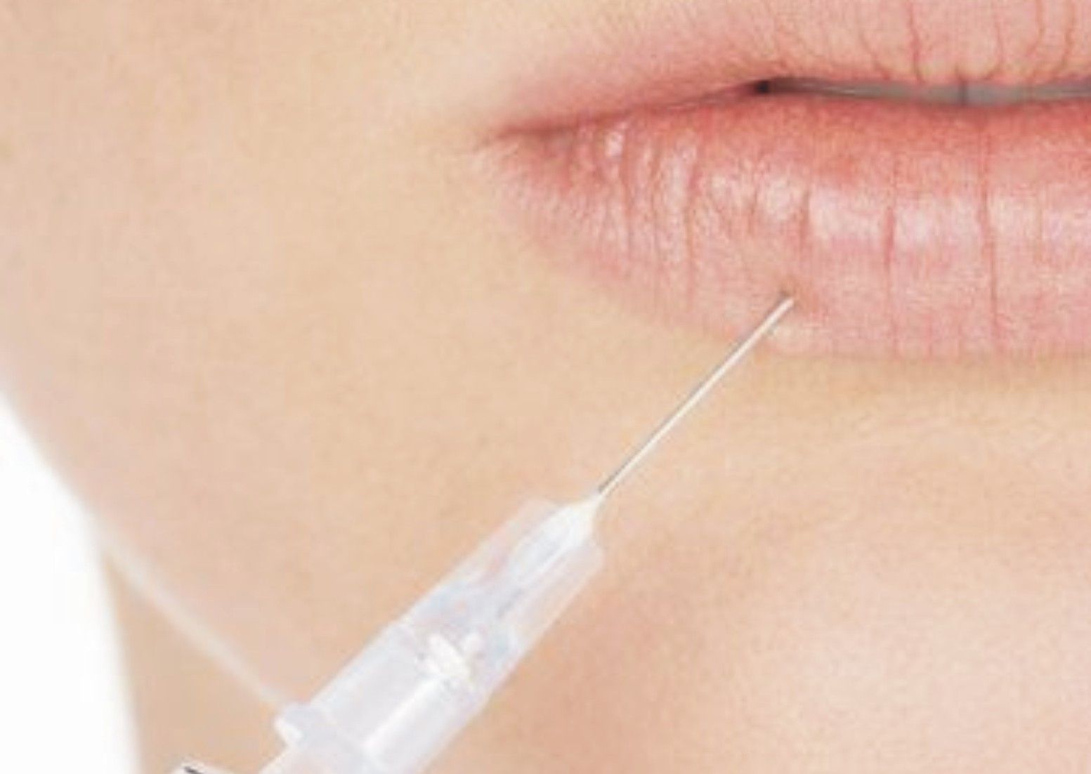 Waspada Suntikan Kolagen Liar - KlikDokter