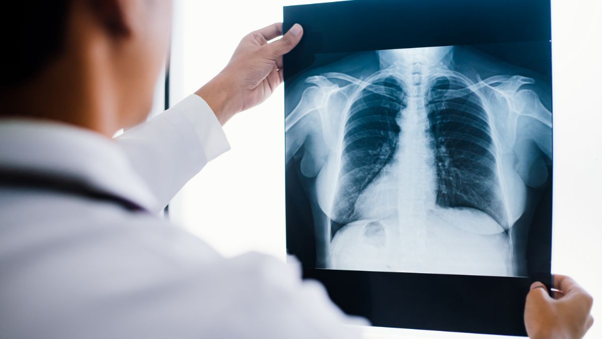 Mengenal Manfaat Rontgen Thorax Dan Prosedurnya Klikdokter