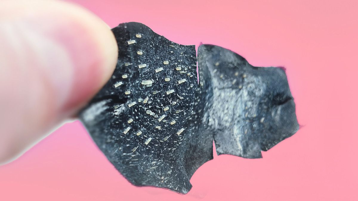 Efektifkah Menggunakan Pore Pack untuk Usir Komedo? - KlikDokter