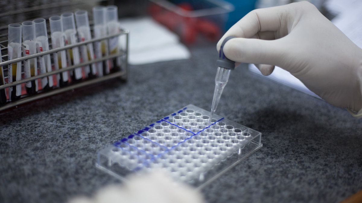 Jenis-jenis Tes HIV yang Wajib Anda Tahu, Apa Saja? - KlikDokter