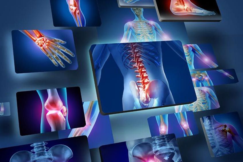 Seputar Radang Sendi - KlikDokter