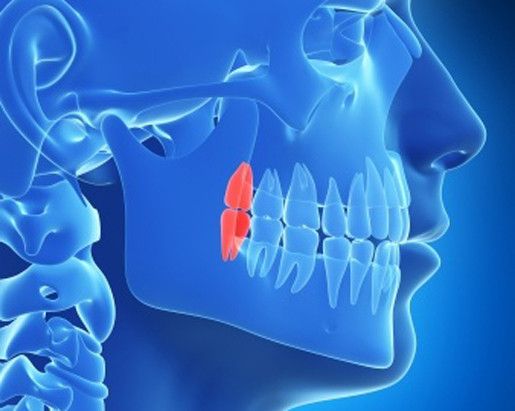 Ketika Gigi Berjumlah Lebih dari Normal - KlikDokter