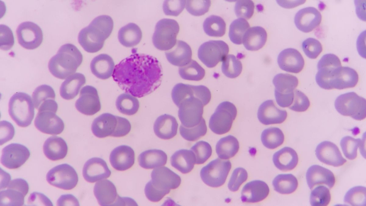 Mengenal Basofil dan Fungsinya untuk Manusia - KlikDokter