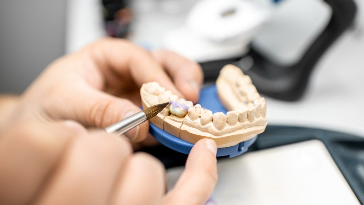 Apa yang Dimaksud dengan Restorasi Gigi? - KlikDokter