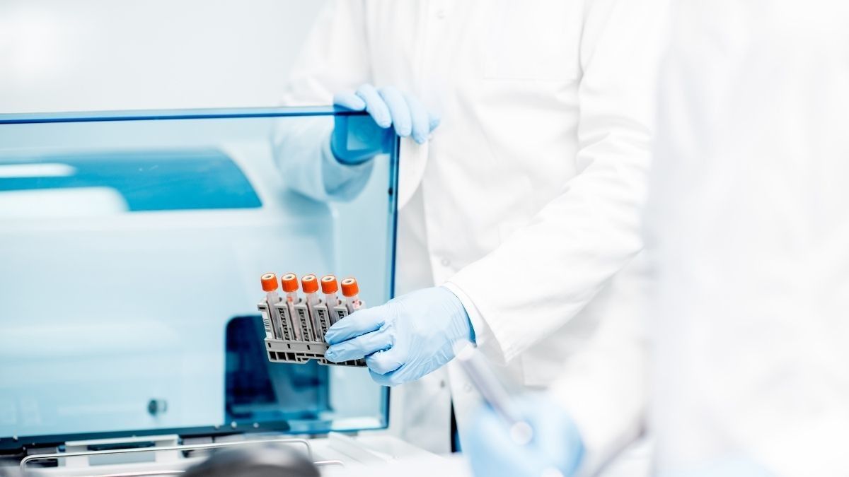 Mengenal Tes Viral Load untuk Mendeteksi Hepatitis C - KlikDokter