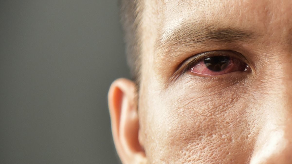 Perokok Berisiko Tinggi Mengalami Edema Makula Diabetik - KlikDokter