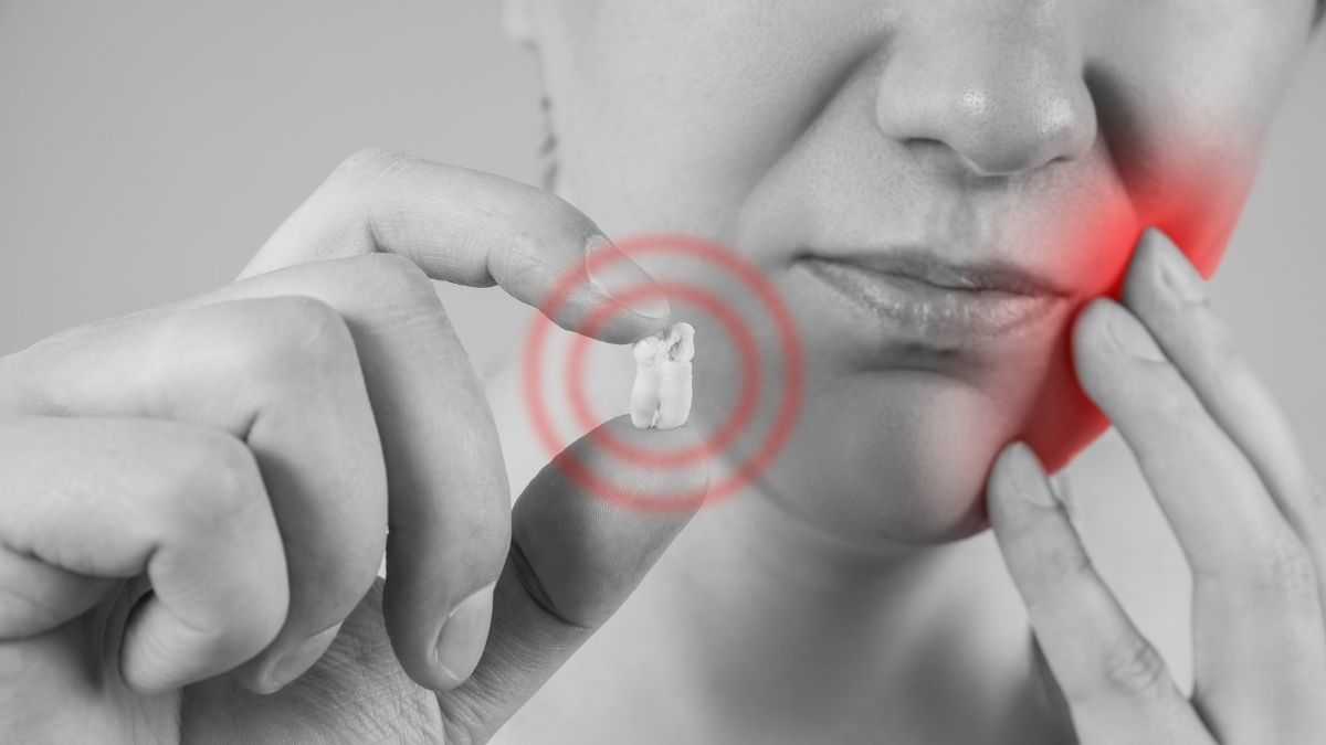 Tips Supaya Cepat Pulih Setelah Cabut Gigi - KlikDokter