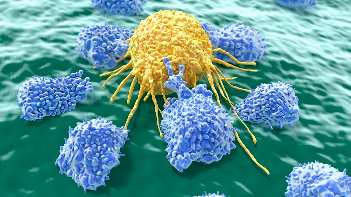 Berapa Lama Pasien Kanker Harus Jalani Kemoterapi? - KlikDokter